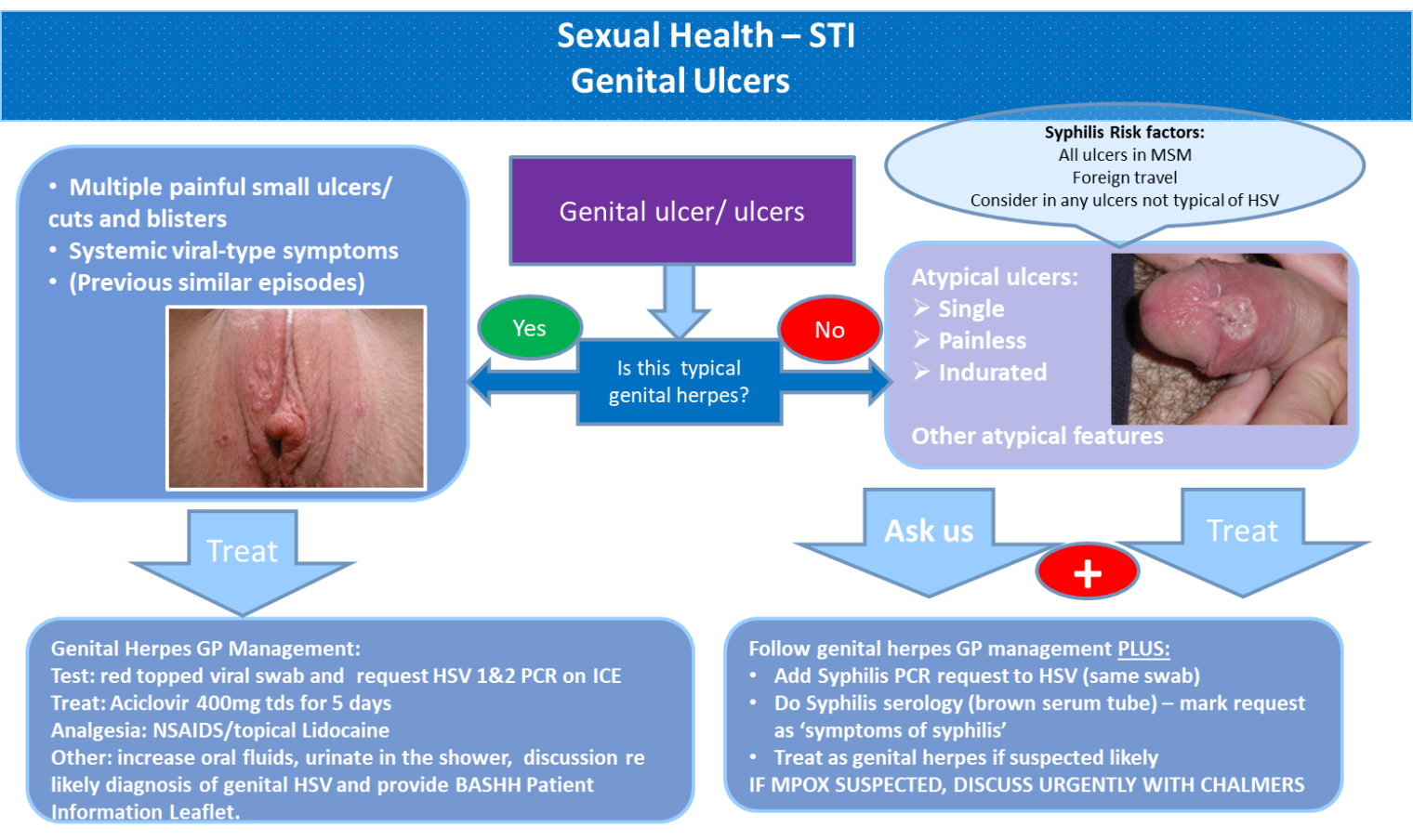 Genital Ulcers/Herpes Simplex – RefHelp